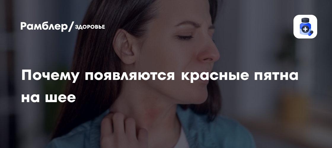 Почему появляются красные пятна на шее Рамблер здоровье
