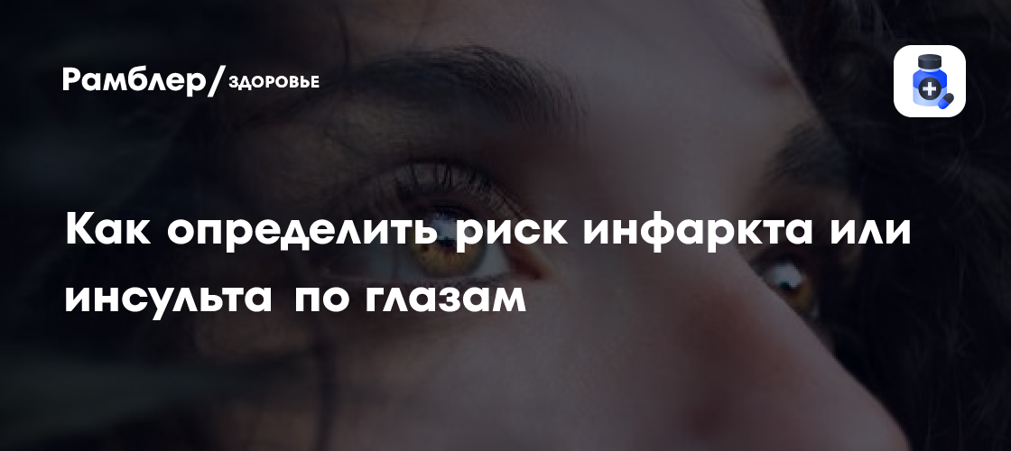 Как определить риск инфаркта или инсульта по глазам Рамблерздоровье