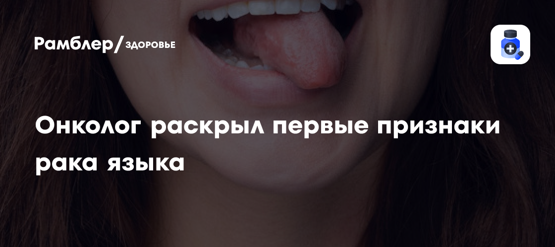 Онколог Борзяница раскрыл первые признаки рака языка Рамблерздоровье