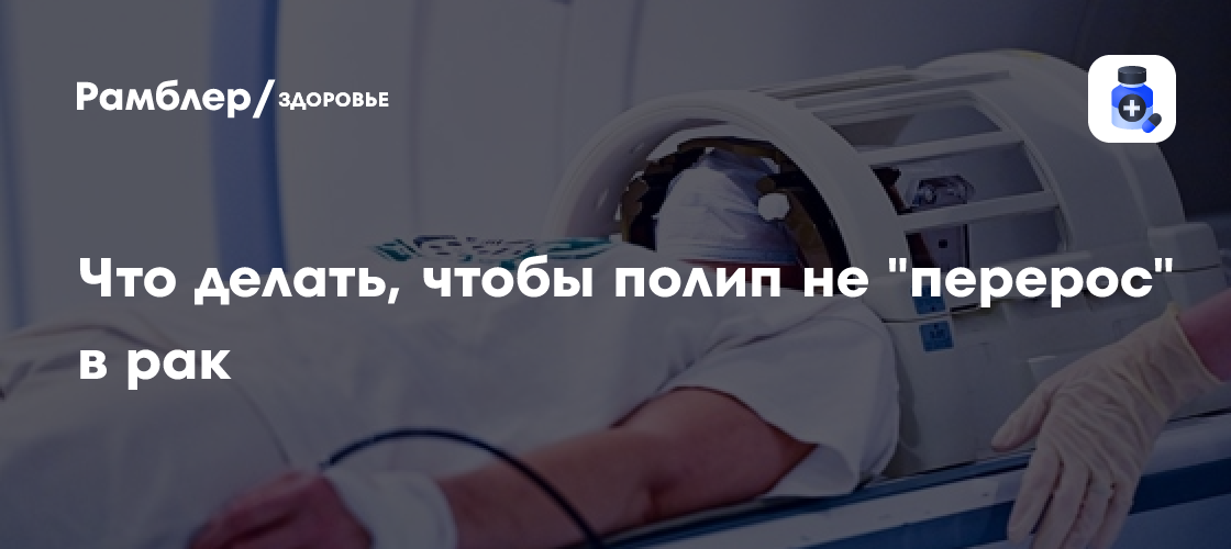 Что необходимо делать чтобы полип не перерос в рак Рамблерздоровье