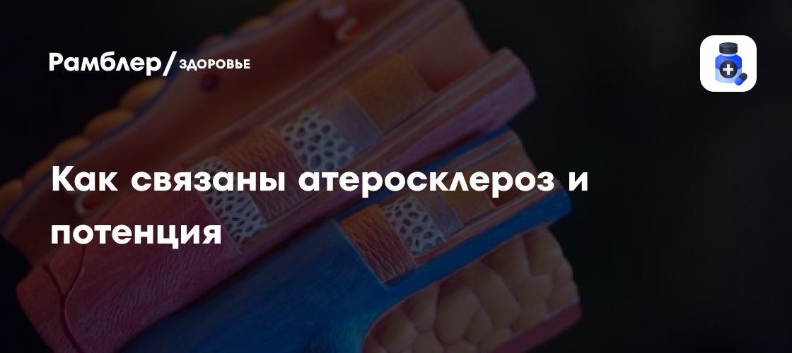 Как связаны атеросклероз и потенция - Рамблер/здоровье