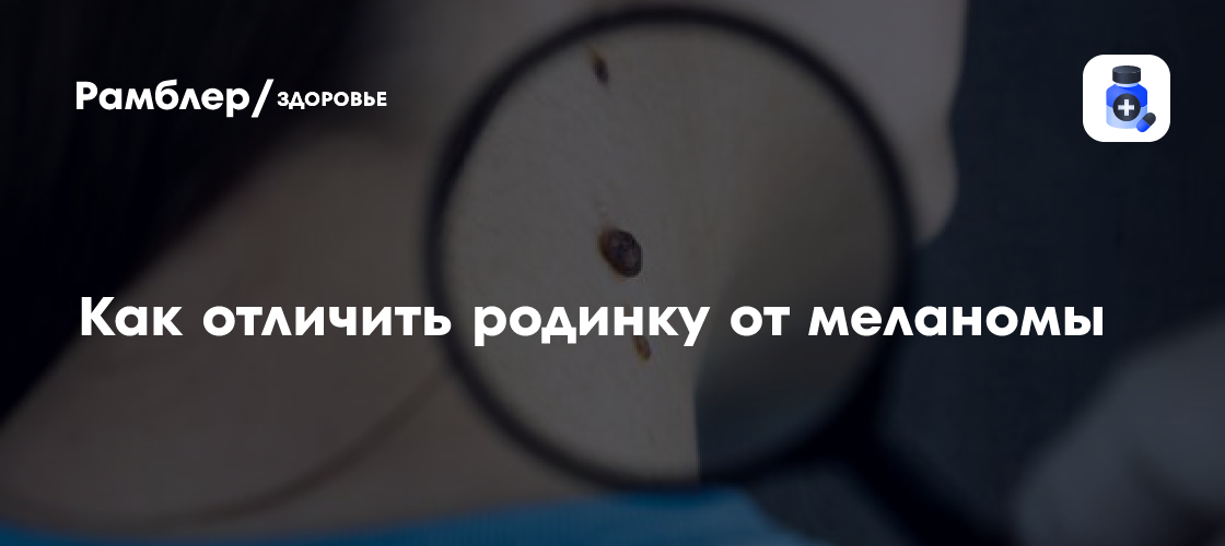 Как отличить родинку от меланомы видео Рамблерздоровье