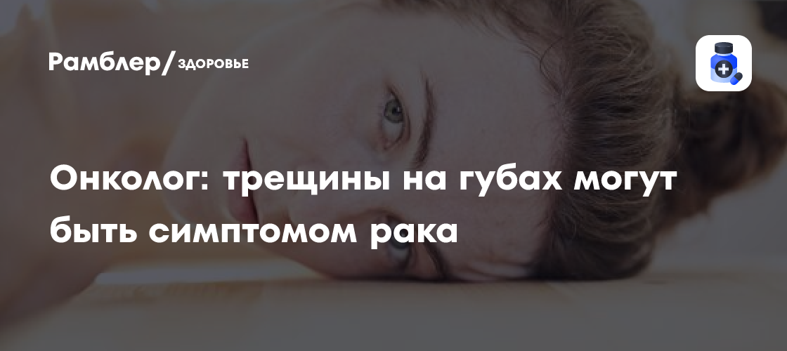 Онколог Романов рассказал что трещины на губах могут быть симптомом