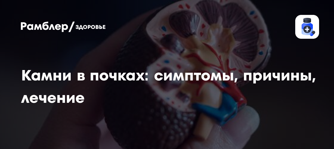 Камни в почках: симптомы, причины, лечение - Рамблер/здоровье