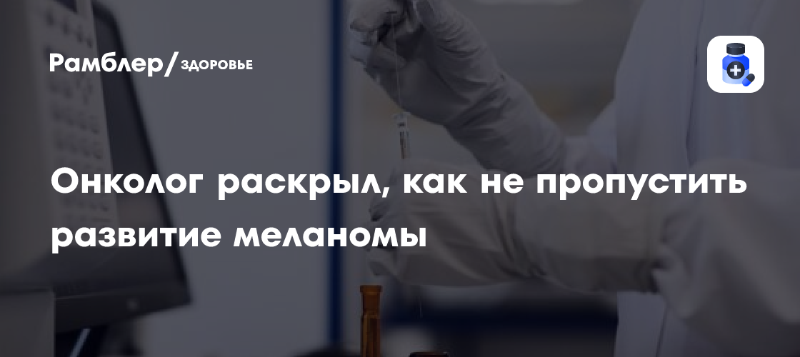 Онколог раскрыл как не пропустить развитие меланомы Рамблерздоровье