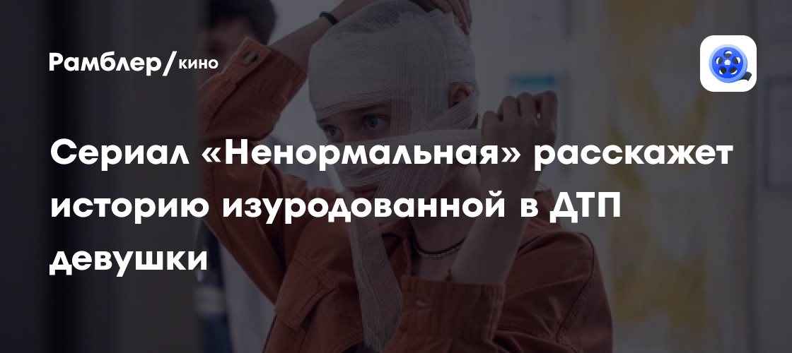 Гид-парк: сериал "Ненормальная" расскажет историю изуродованной в ДТП ...