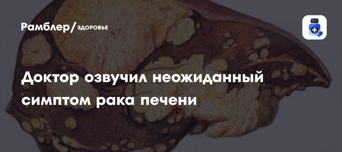 Озвучен неожиданный симптом рака печени Рамблерздоровье