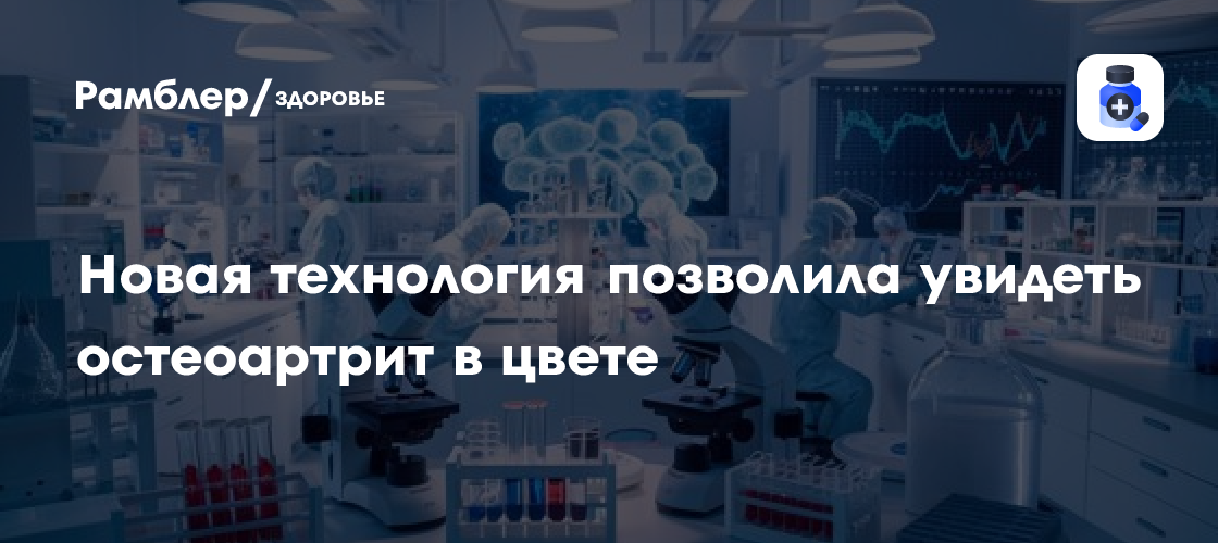 Новая технология позволила увидеть остеоартрит в цвете - Рамблер/здоровье