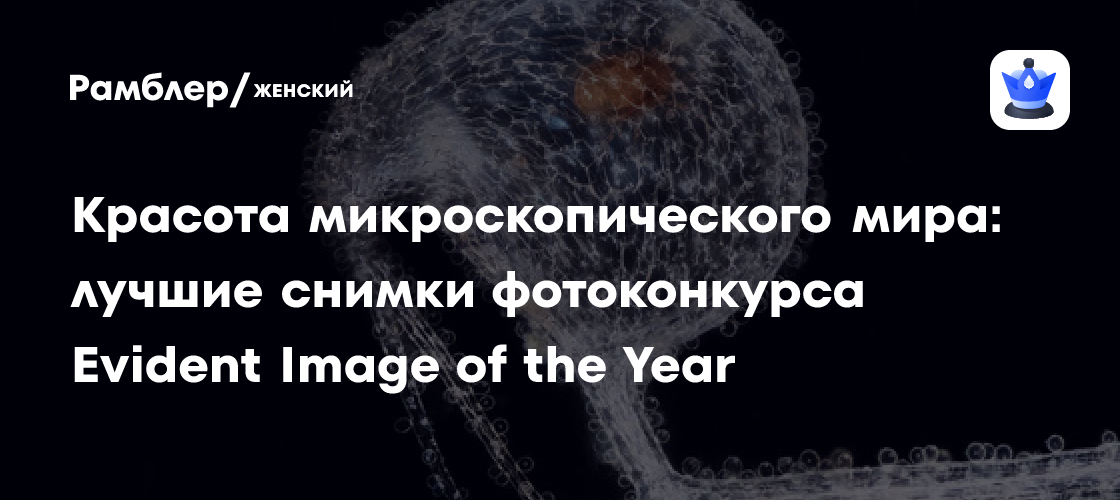 Красота микроскопического мира: лучшие снимки фотоконкурса Evident ...